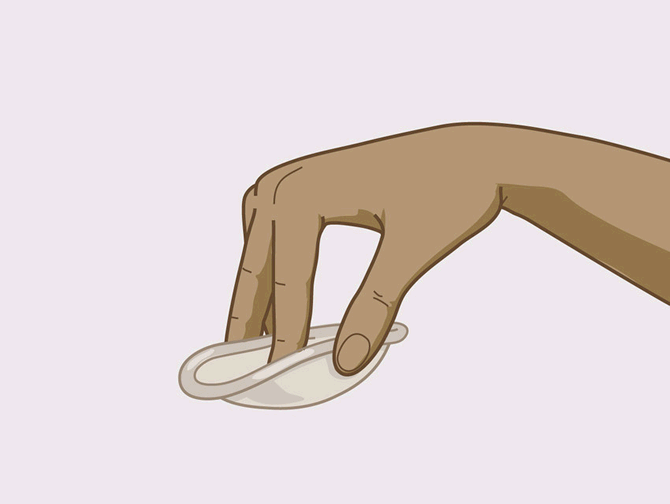 Het pessarium: voor- en nadelen van het pessarium